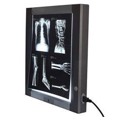 LED X-ray Film Viewer Negatoscope Xray View Box Illuminator Medical ...